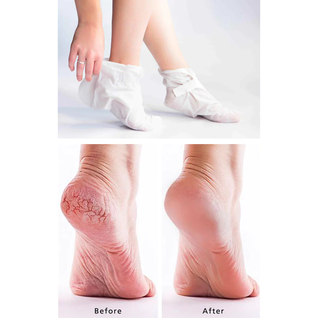 MEDIHEAL Paraffin Foot Sheet Mask Bundle (5 Pairs) – Oz Hair and Beauty